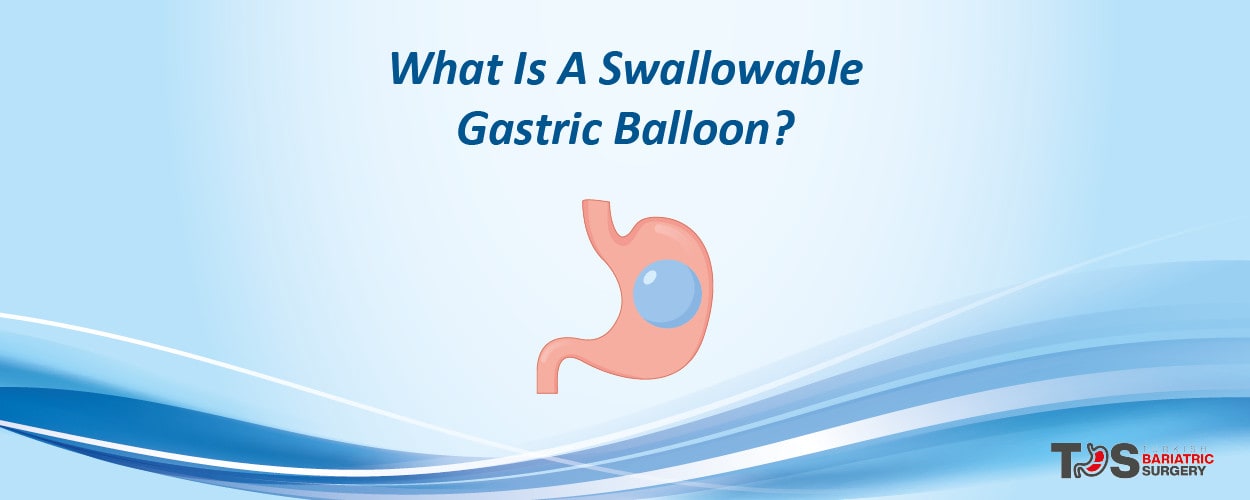 What is a swallowable gastric balloon? - Turkish Bariatric Surgery