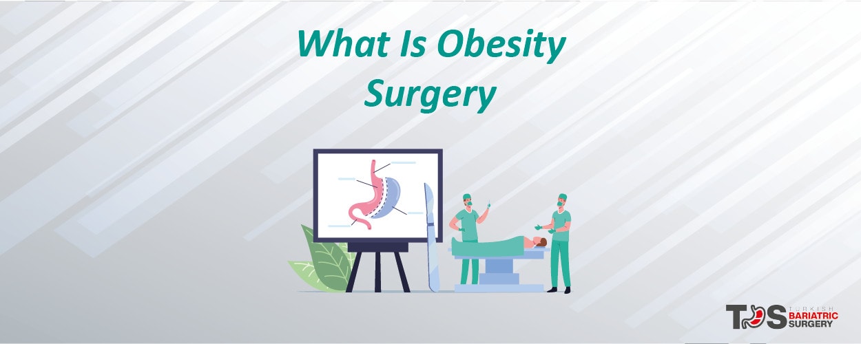 WHAT IS OBESITY SURGERY? - Turkish Bariatric Surgery