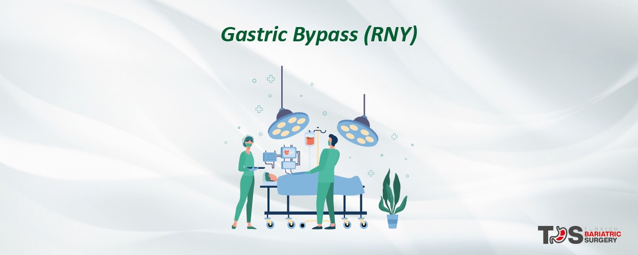 GASTRIC BYPASS (RNY) - Turkish Bariatric Surgery
