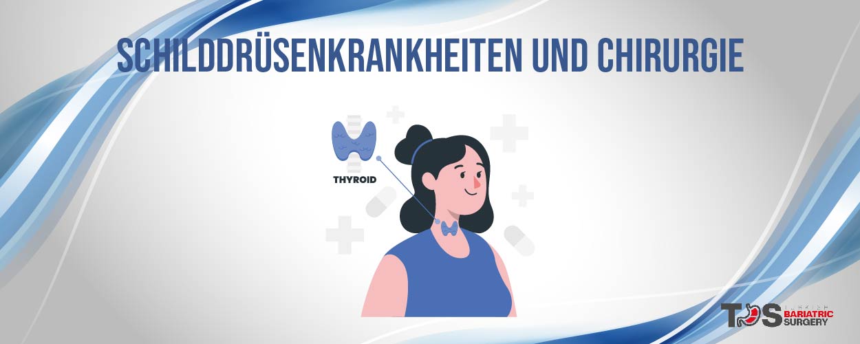 Schilddrüsenkrankheiten und Chirurgie - Turkish Bariatric Surgery