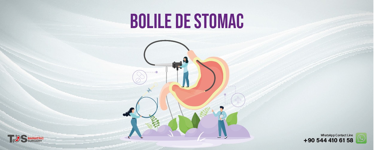 Bolile de stomac - Turkish Bariatric Surgery