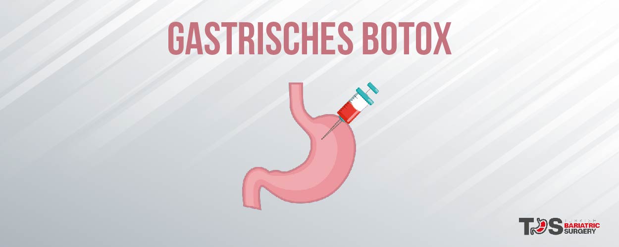 GASTRISCHES BOTOX - Turkish Bariatric Surgery